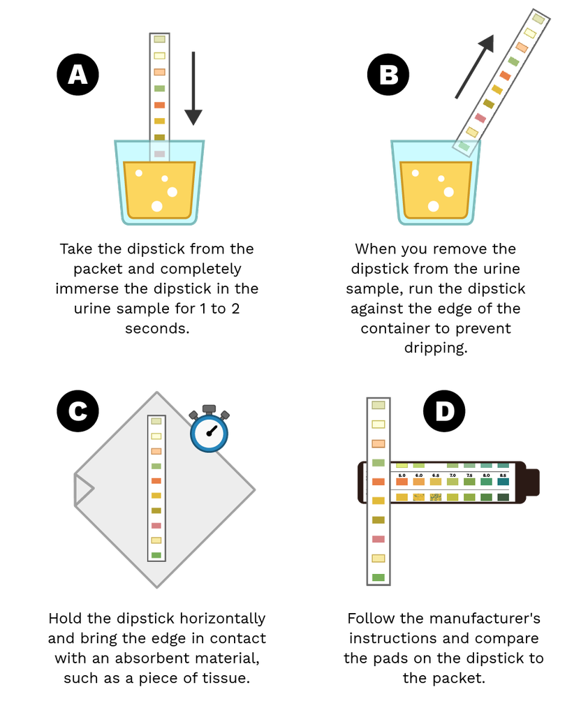 Dipstick Test For Urine Labster Dipstick Test For Urine Labster